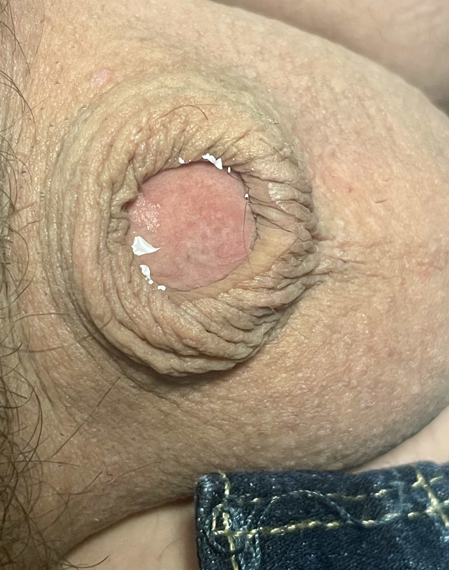 Inverted Micro Penis Tiny Dick Pre Cum 1 Pics Xhamster 