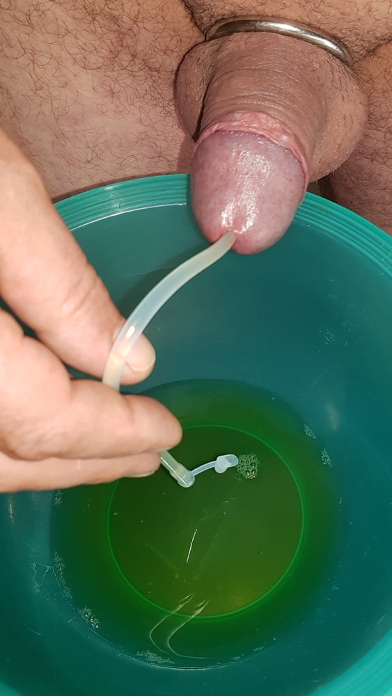 Catheter Insertion 111 Pics Xhamster 8674